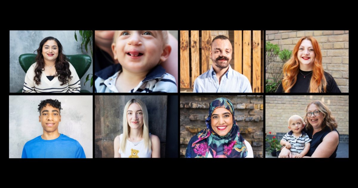 Celebrating 'Beauty In Every Smile' as people affected by facial ...